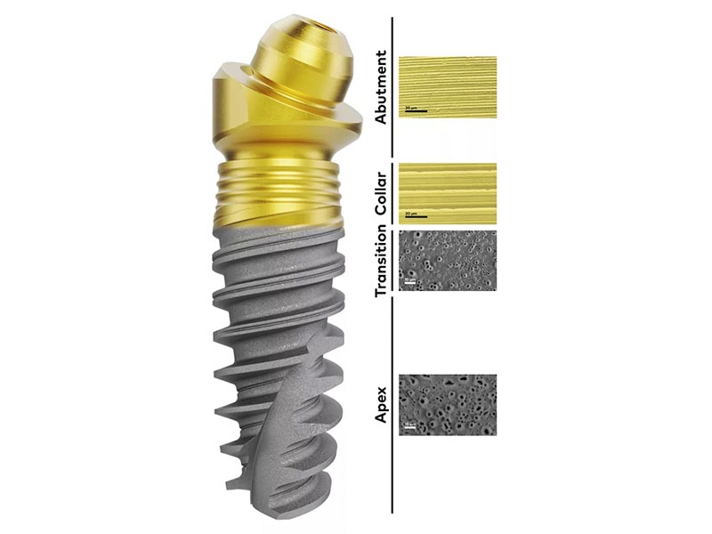 nobel-biocare-諾保科植體-植牙成功率